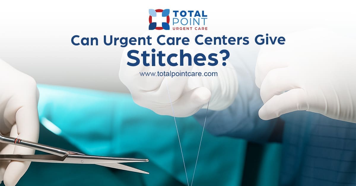 Can Urgent Care Centers Give Stitches? Your Guide to Getting Stitches ...
