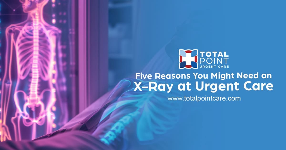 Five Reasons You Might Need an X-Ray at Urgent Care | Total Point Care