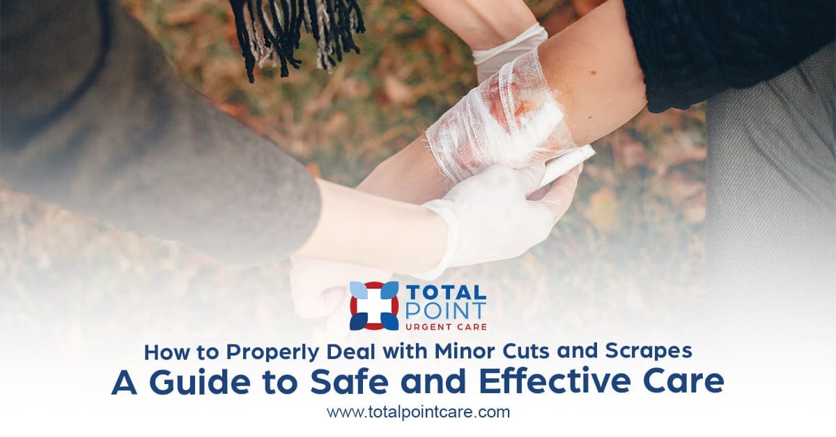 How to Properly Deal with Minor Cuts and Scrapes: A Guide to Safe and ...